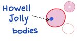 Σωμάτια Howell-Jolly - Emedi.gr - Πρόληψη Υγείας
